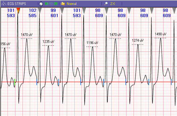 Manual CardioScan